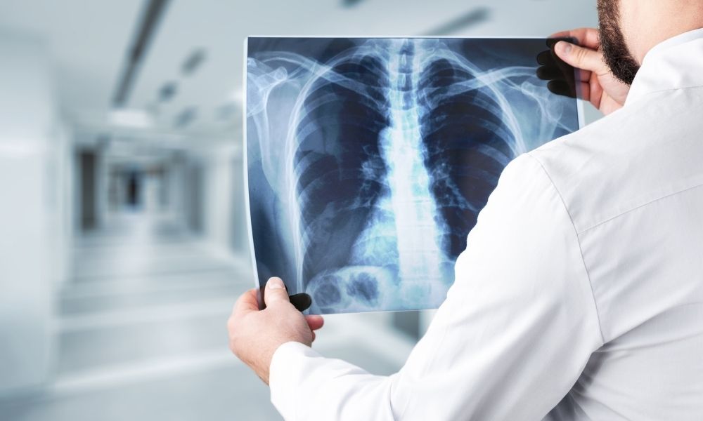 Digital X-Ray Services | Universal Imaging & Radiology Miami